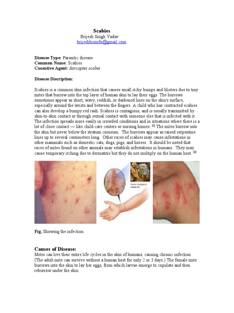 Parasitic Disease (Scabies) | PDF | Medicine | Medical Specialties