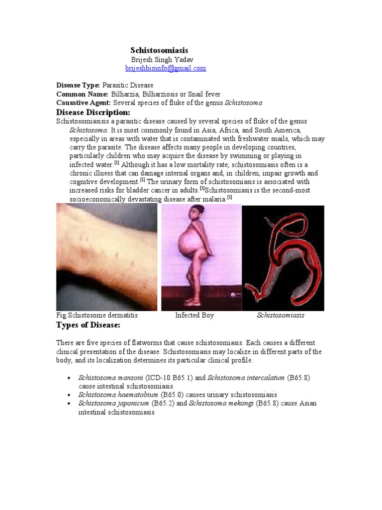 Parasitic Disease (Schistosomiasis) | Medical Specialties | Clinical ...