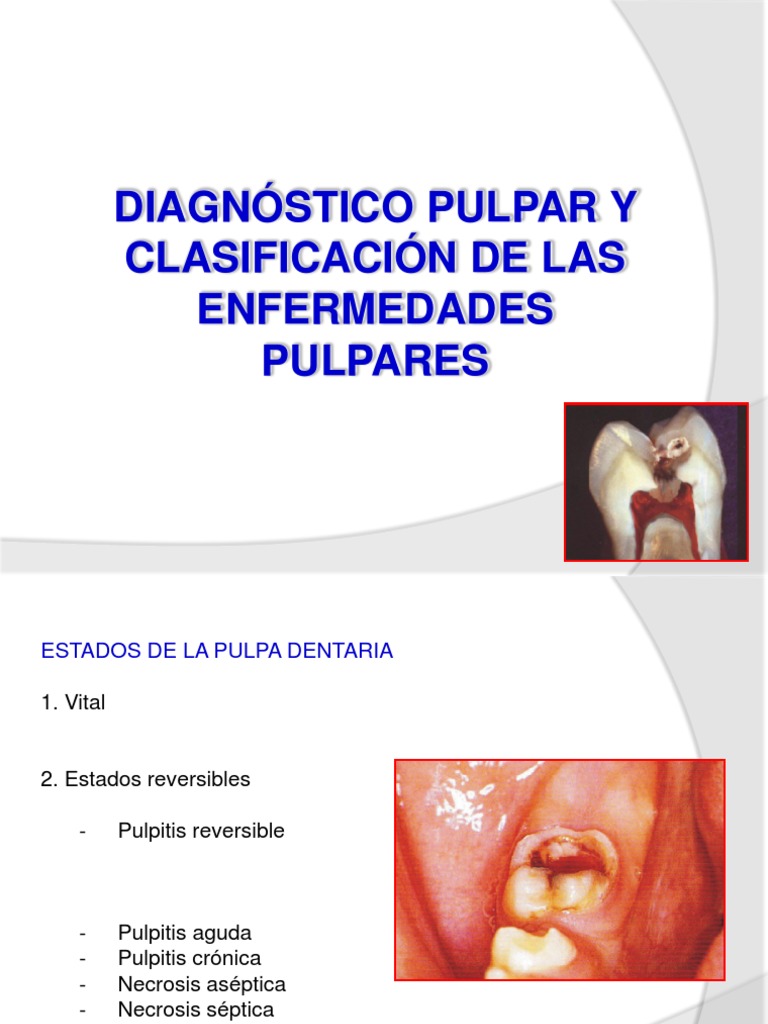 Diagnóstico Pulpar | PDF | Dolor | Enfermedades y trastornos