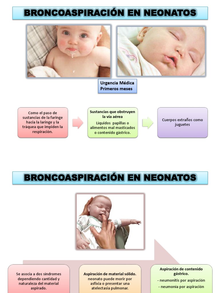 Aspiracion Neonatal | PDF