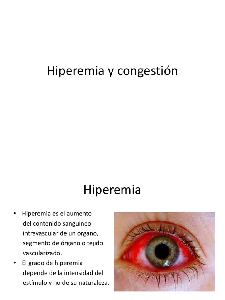 Hiperemia y Congestión: Definiciones y Tipos | PDF | Coagulación | Edema