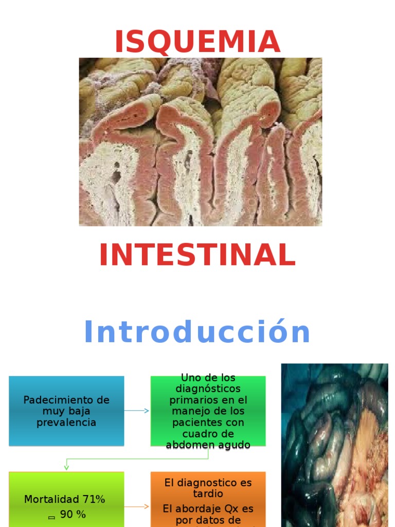 Isquemia Intestinal | PDF | Isquemia | Enfermedades vasculares