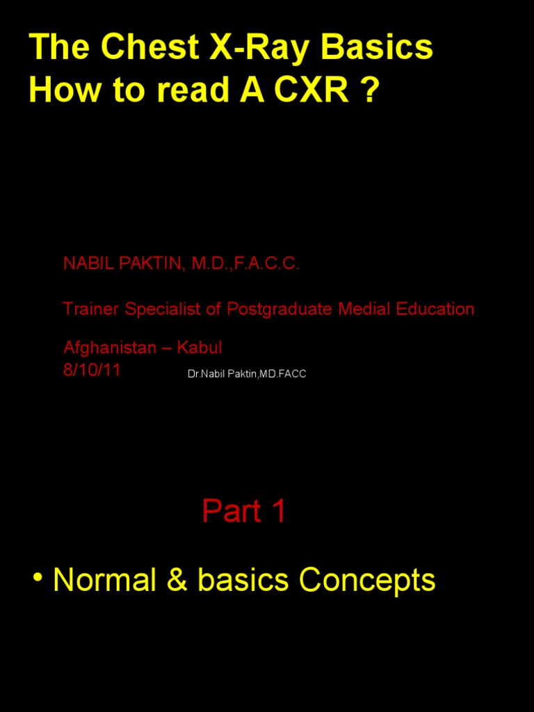 How To Read A CXR | PDF | Aorta | Human Anatomy