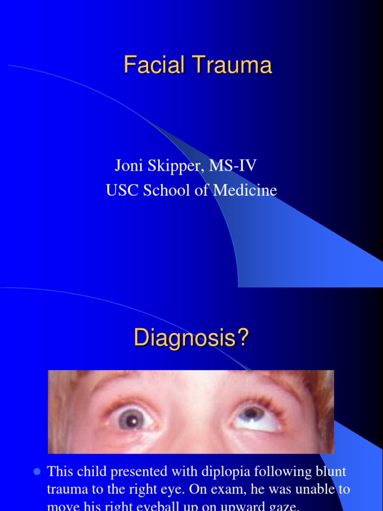 Diagnosing and Managing Facial Trauma: A Focus on Orbital Blowout ...
