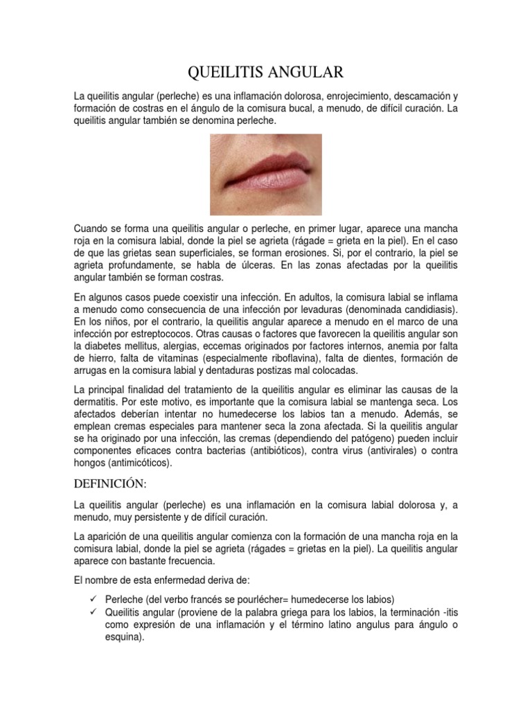 Queilitis Angular | PDF | Especialidades Medicas | Medicina