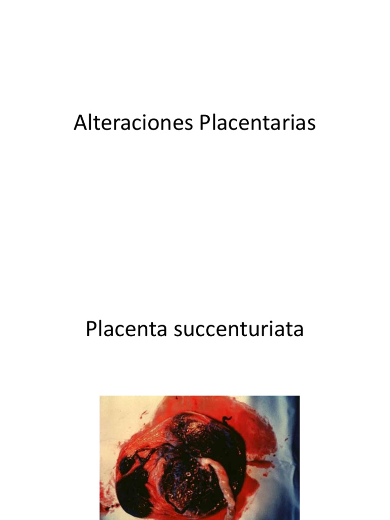 Tipos y Alteraciones de la Placenta | PDF | Ciencia y matemáticas