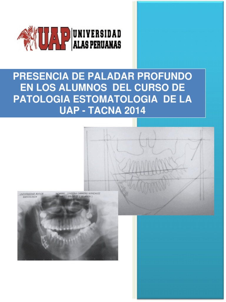 Paladar Profundo | Respiración | Rasgos faciales