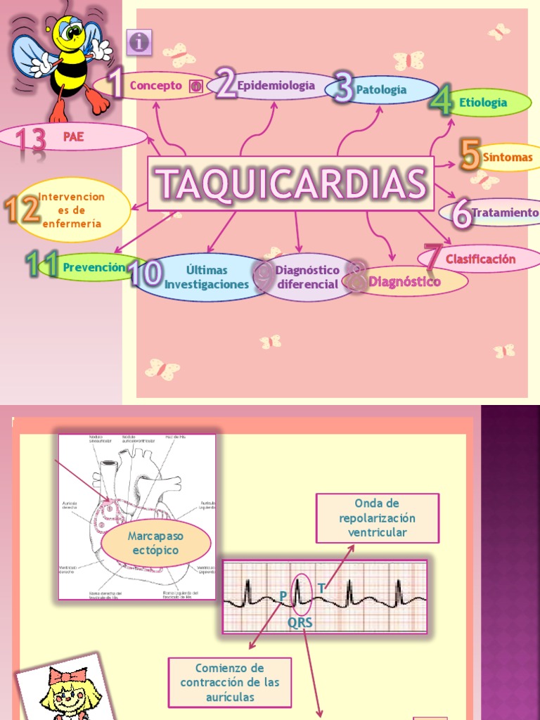 TAQUICARDIAS | Arritmia cardiaca | Electrocardiografia