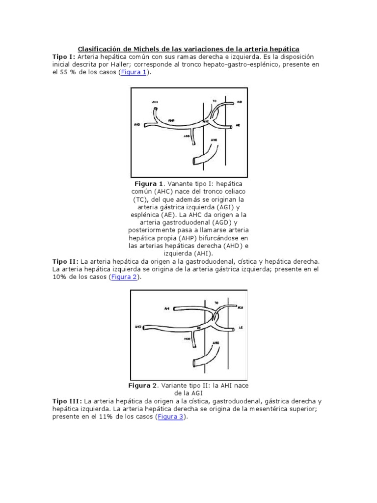 Clasificación de Michels de Las Variaciones de La Arteria Hepática ...