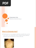 Chicken Pox Presentation | PDF | Animal Virology | Virology