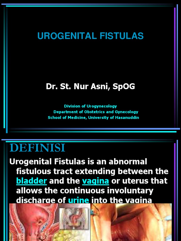 Fistula Ug | Vagina | Urinary Bladder