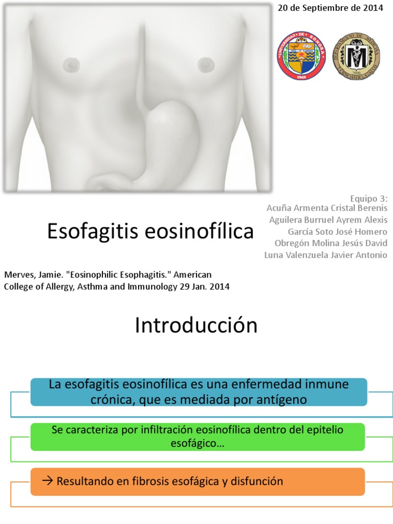 Art 2 Esofagitis Eosinofílica | PDF | Especialidades Medicas ...