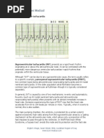 ROTEM Interpretation | PDF | Coagulation | Blood