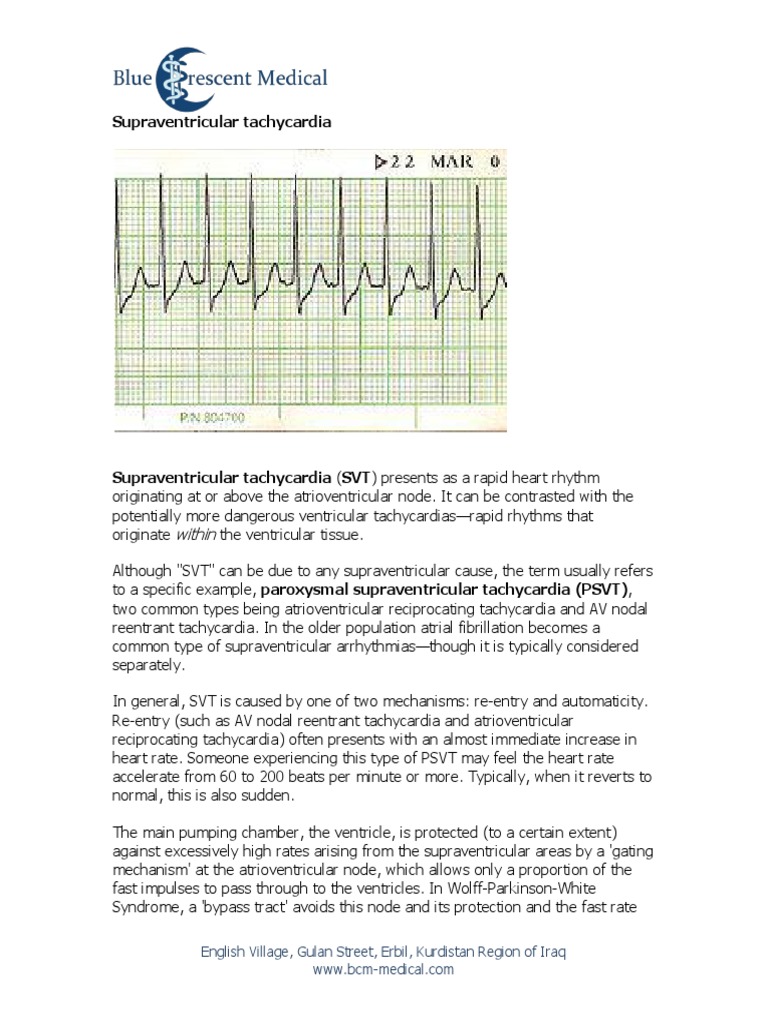 Supraventricular Tachycardia | Cardiology | Electrophysiology