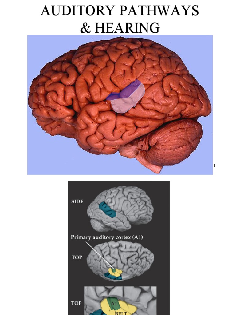 Central Auditory Pathways | Auditory System | Hearing