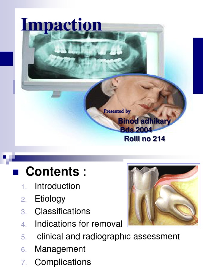 On Impaction | PDF | Tooth | Mouth