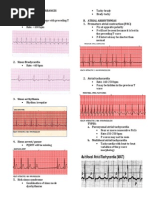 EKG Pocket Guide | PDF | Cardiac Electrophysiology | Electrocardiography