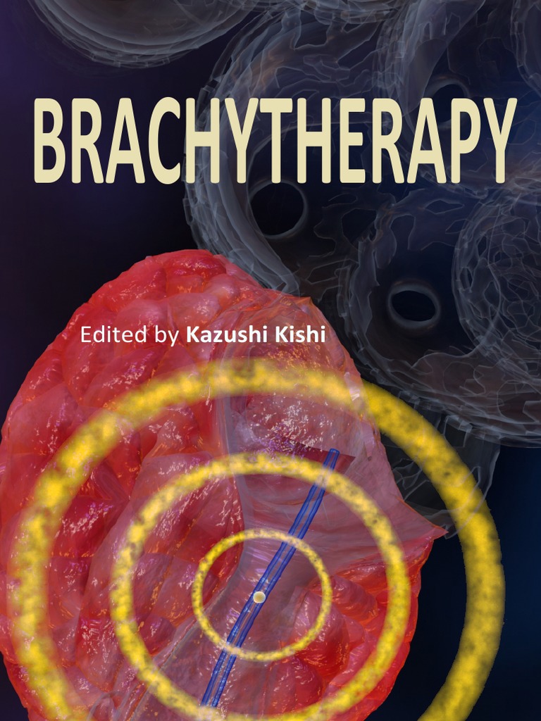 Brachytherapy | Download Free PDF | Dosimetry | Radiation Therapy