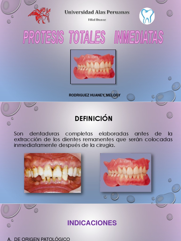 Protesis inmediata | Dentadura postiza | Diente humano