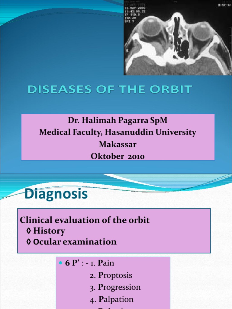 15.10.10-Diseases of The Orbit (Pptminimizer) | PDF | Health Sciences ...