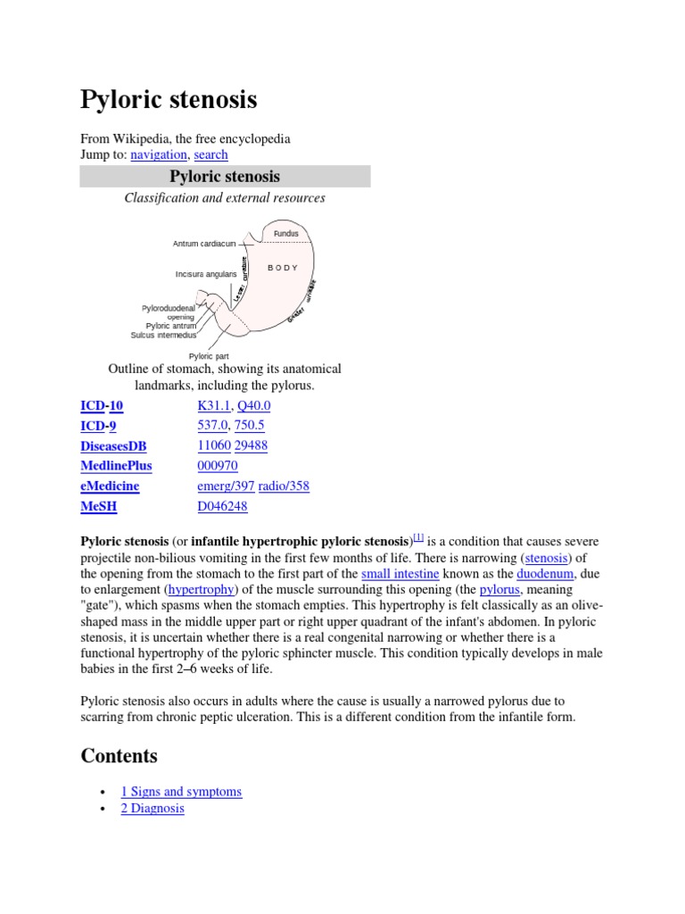 Pyloric Stenosis: A Review of the Signs, Diagnosis, Treatment, and ...