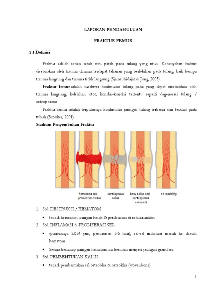 LP Fraktur Femur | PDF