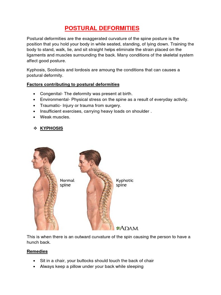 Postural Deformities | PDF | Abdomen | Musculoskeletal System