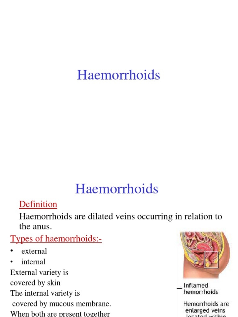 Understanding Haemorrhoids: Types & Treatment | PDF
