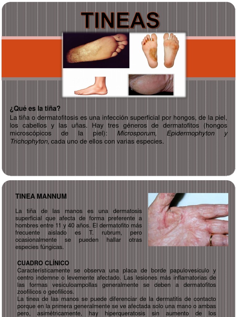 Tineas | PDF | Animales y humanos | Ciencias de la Salud
