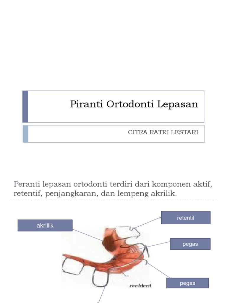 Piranti Ortodonti Lepasan | PDF
