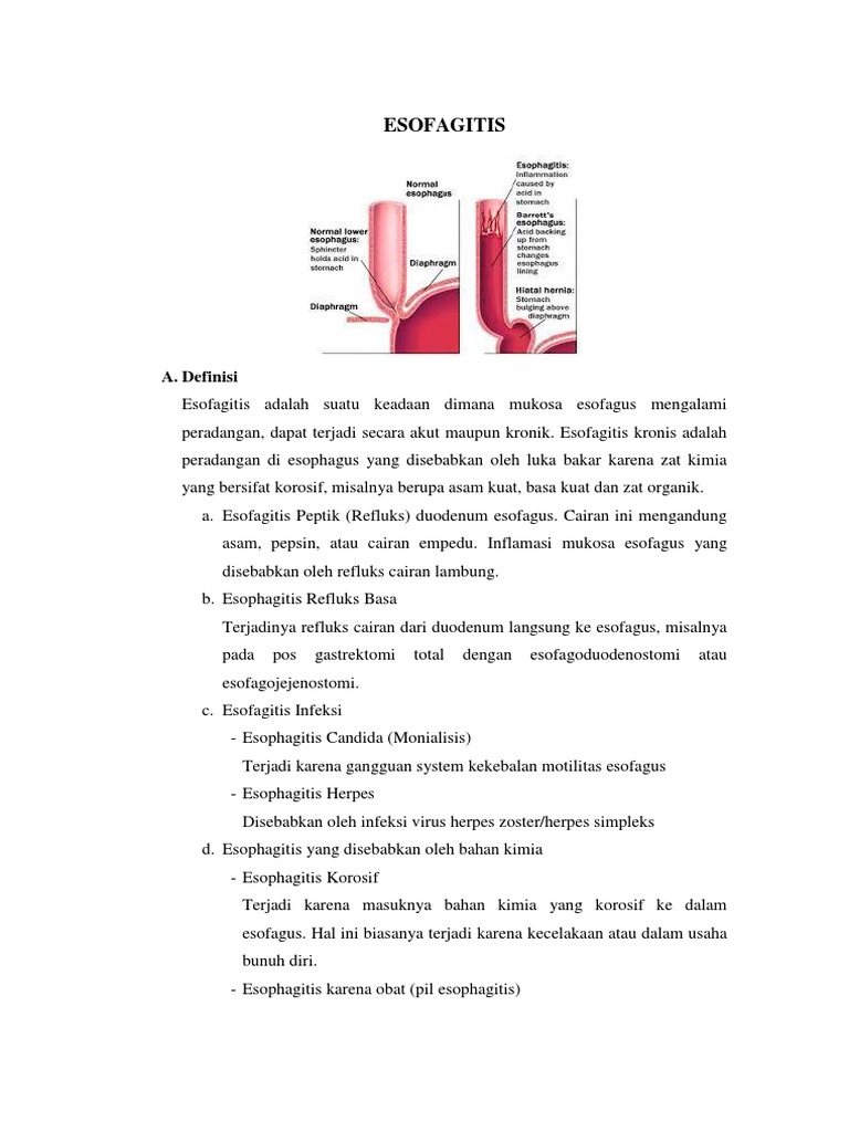 ESOFAGITIS | PDF