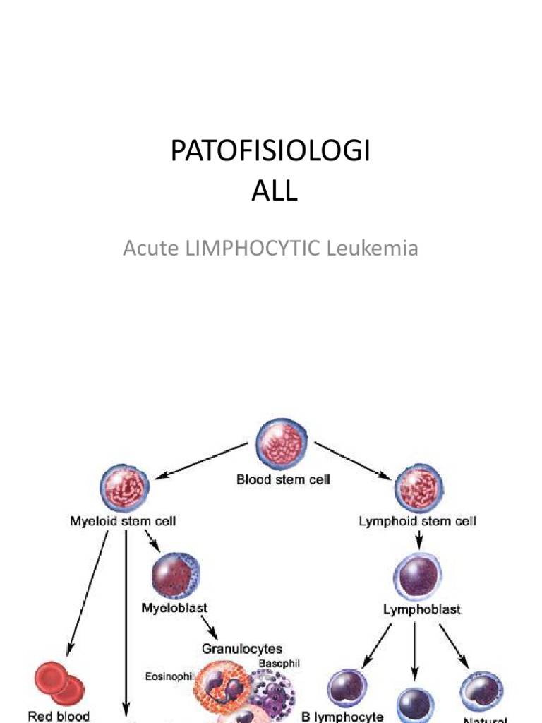 Patofisiologi Leukemia Limfoblastik Akut | PDF