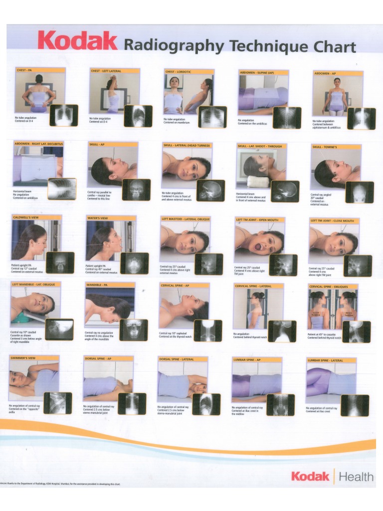 Kodak Radiography Technique Chart | PDF