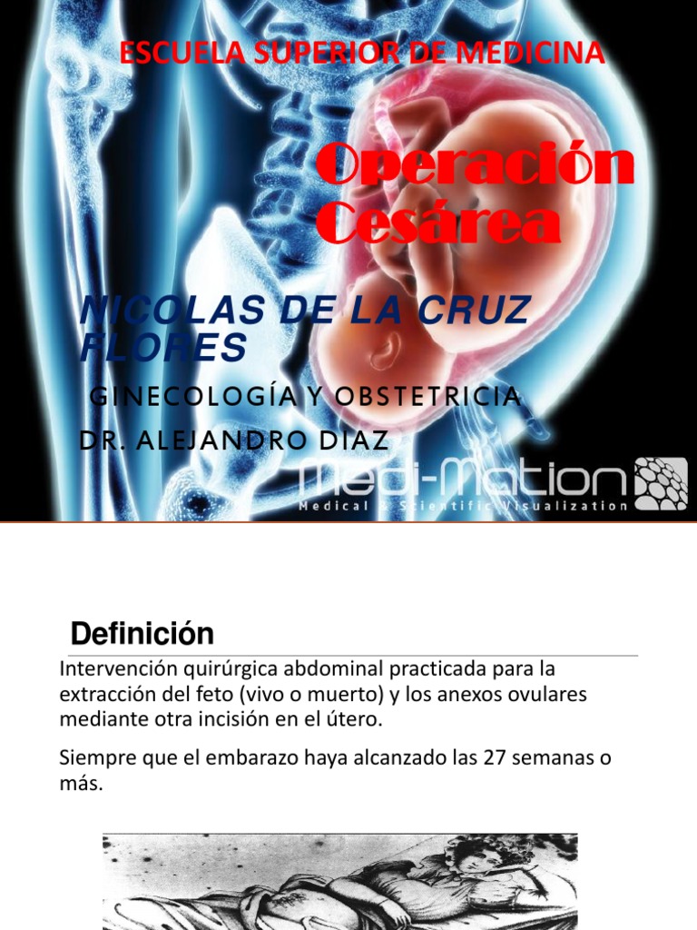 OPERACION CESAREA.pptx | Parto | Útero