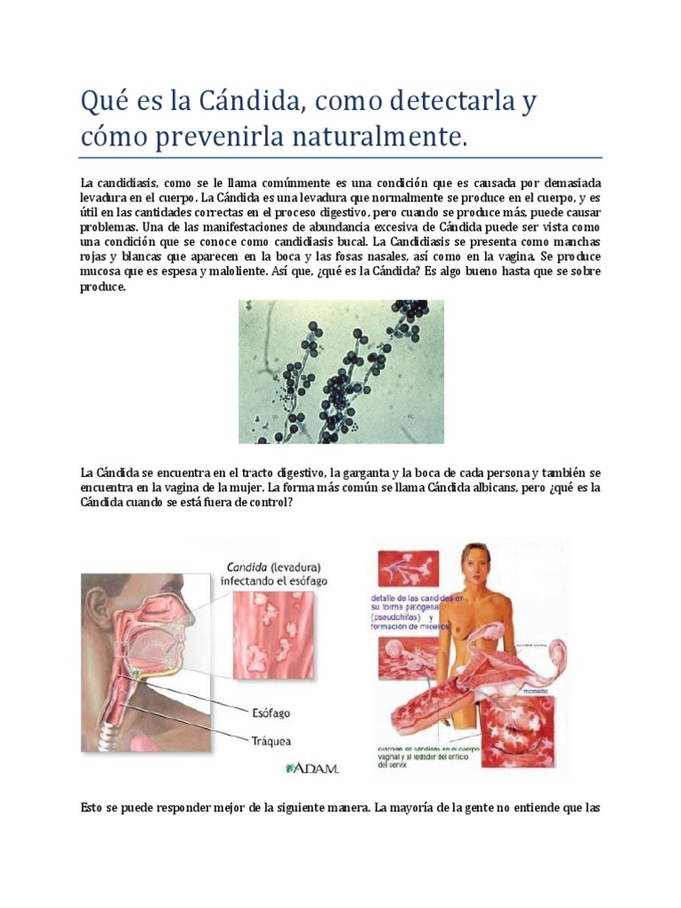 Cándida: Detección y Prevención Natural | PDF | Candidiasis | Candida ...