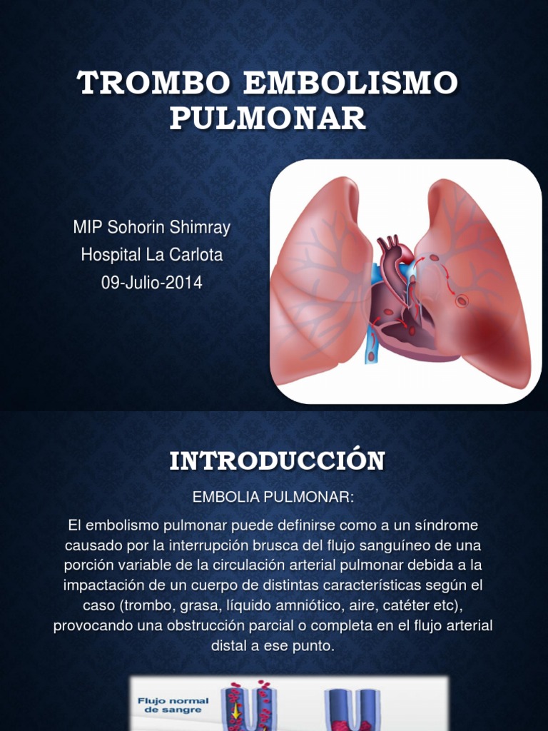 Trombo embolismo Pulmonar.pptx | Trombo | Enfermedades y trastornos