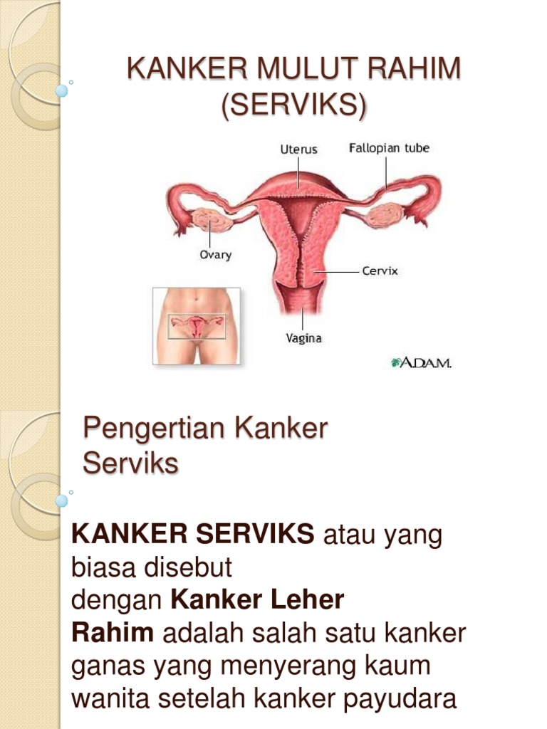 Kanker Mulut Rahim | PDF