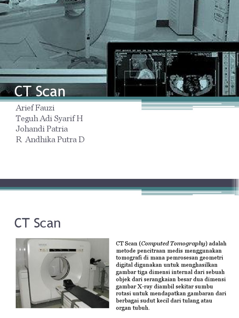 Understanding CT Scans | PDF