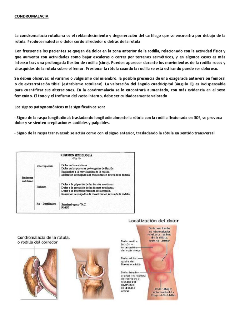 Condromalacia | PDF | Rodilla | Medicina CLINICA
