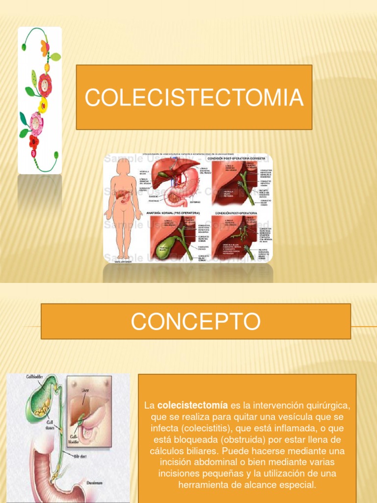 COLECISTECTOMIA CON IMAGENES - PPTX Terminada | PDF | Medicina ...