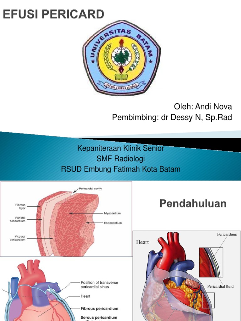 Efusi Pericard | PDF