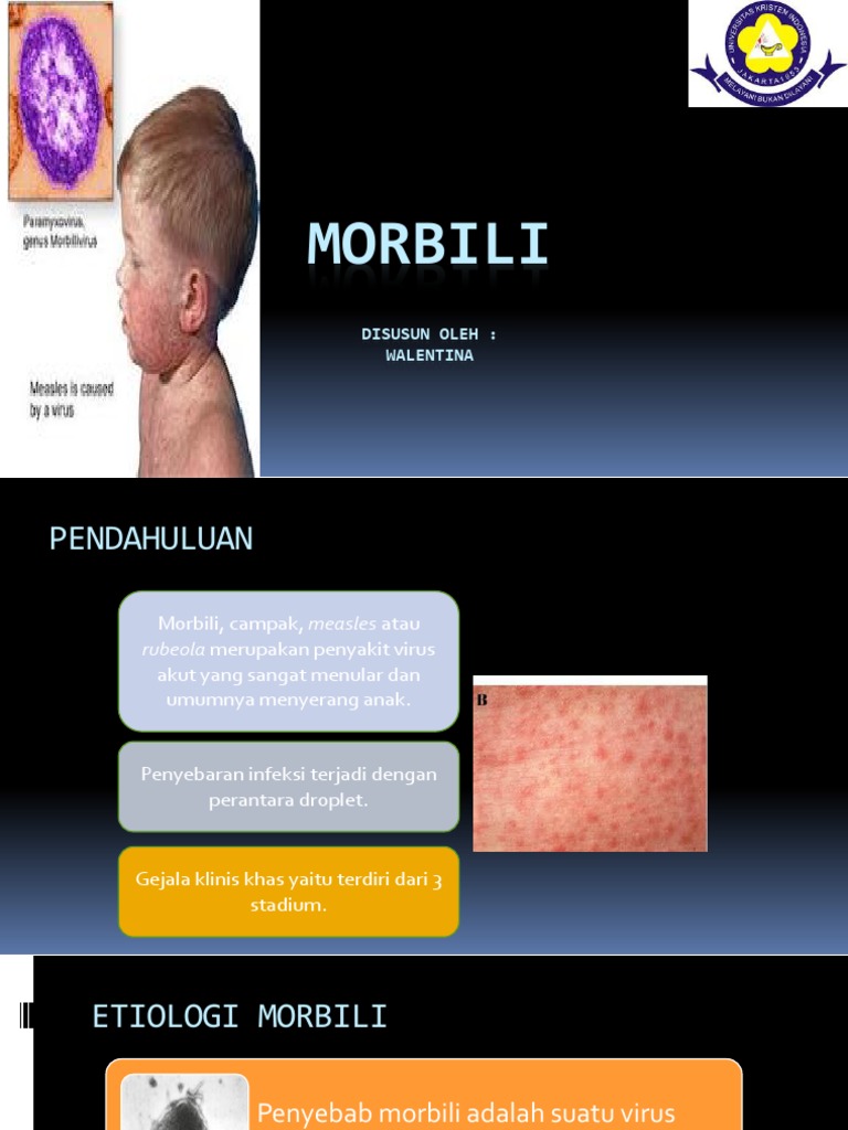 Morbili PPT 2 | PDF | Pengembangan Diri | Sains & Matematika