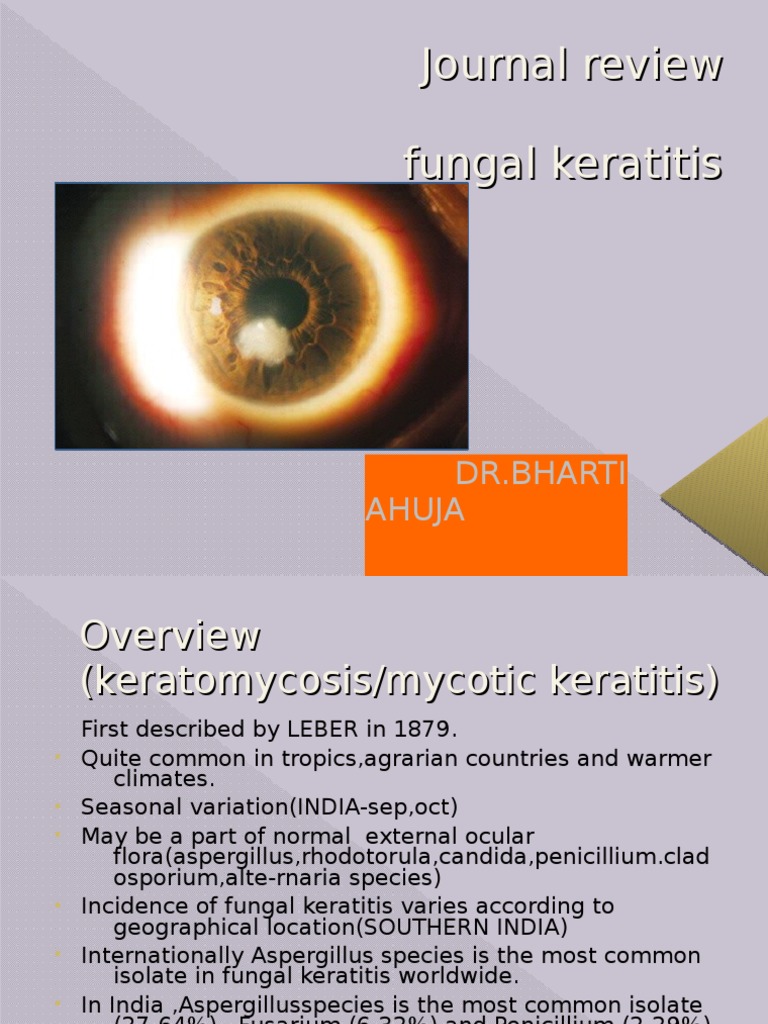 Fungal keratitis | Contact Lens | Ophthalmology