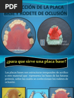 Festoneado en Odontología y Prótesis Total | PDF | Dentadura postiza ...