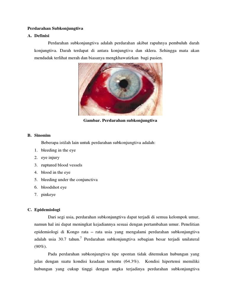 Tatalaksana Perdarahan Subkonjungtiva | PDF