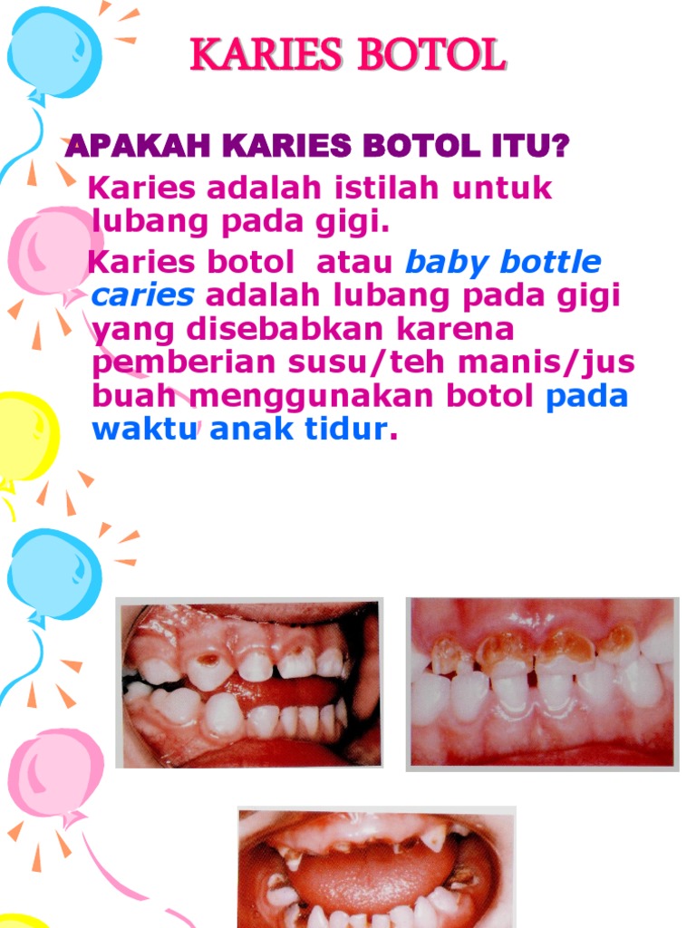 Karies Botol | PDF | Kesehatan Holistik | Gaya Hidup