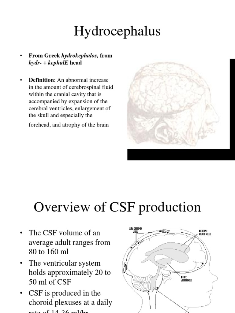 Hydrocephalus | PDF | Cerebrospinal Fluid | Neurological Disorders