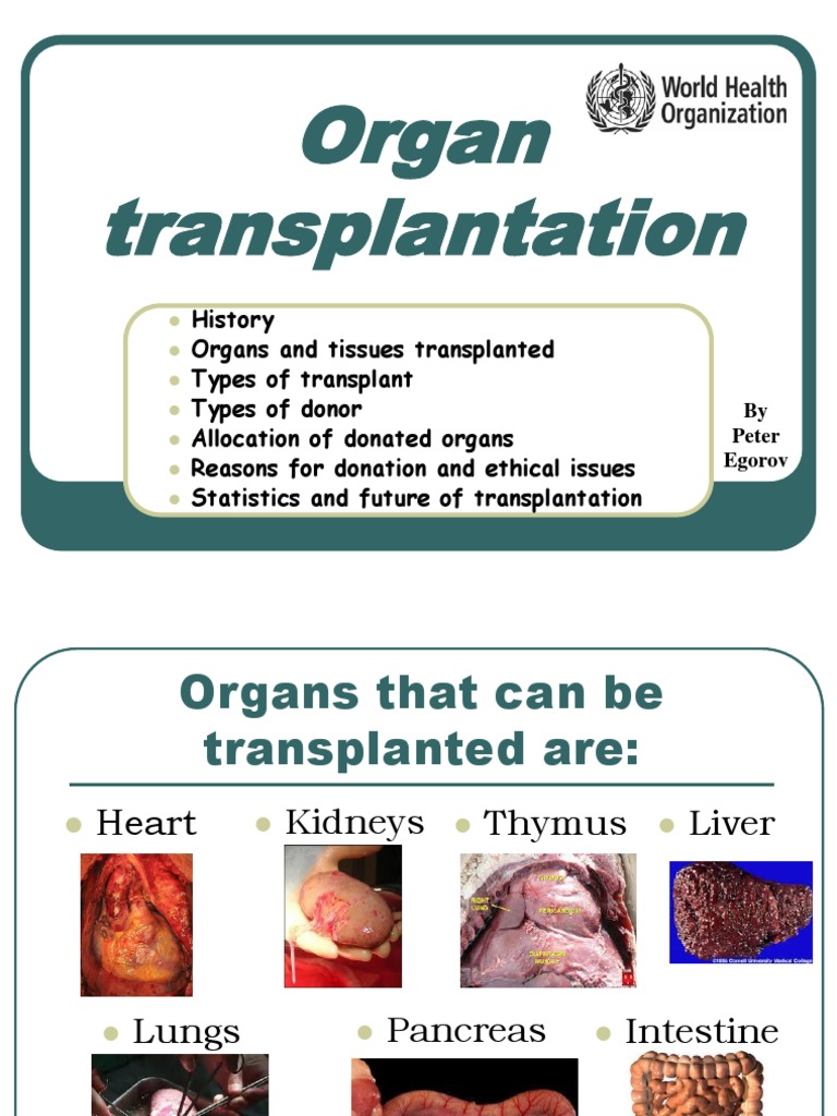 organtransplantation-130429210618-phpapp02.ppt | Organ Transplantation ...