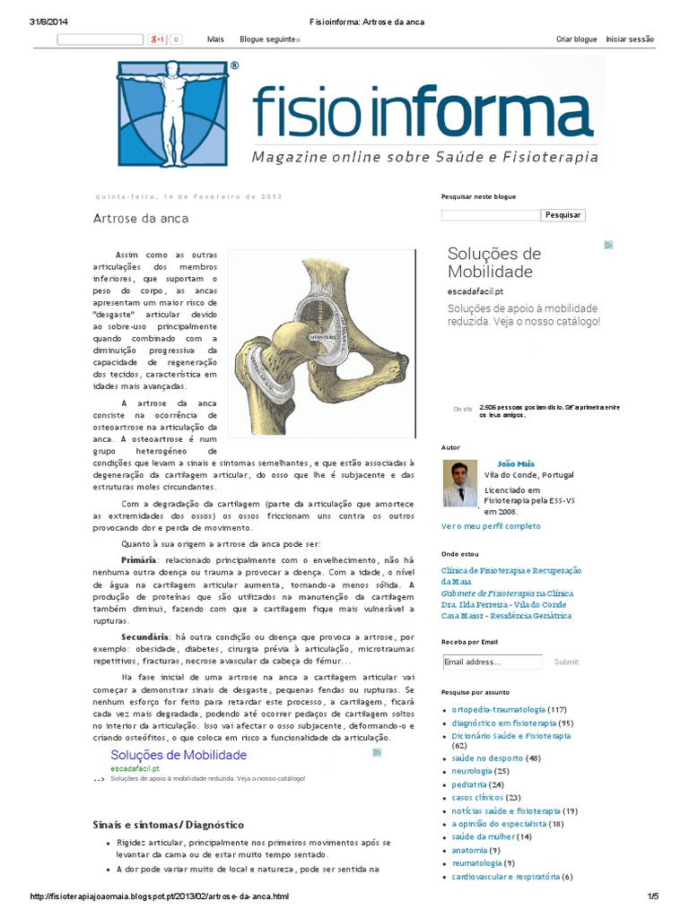 Artrose da Anca: Causas e Sintomas | PDF | Osteoartrite | Sistema Locomotor
