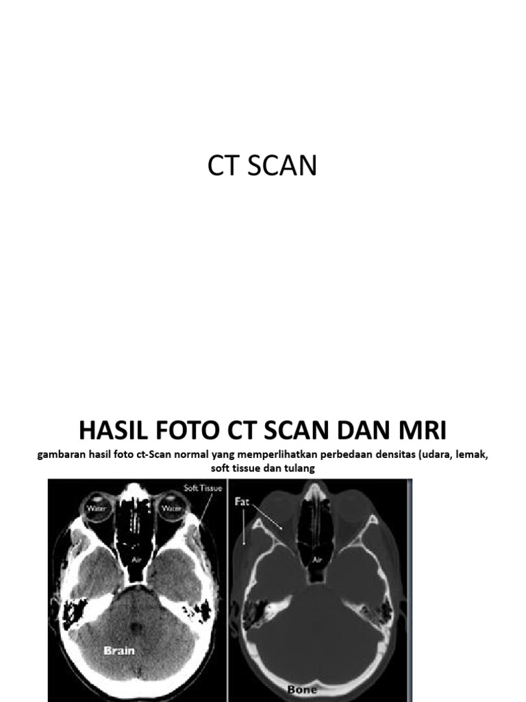 CT Scan | PDF